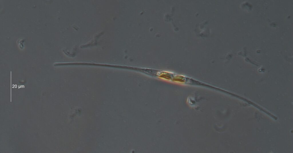 NJDEP| Division of Science and Research | Cylindrotheca closterium