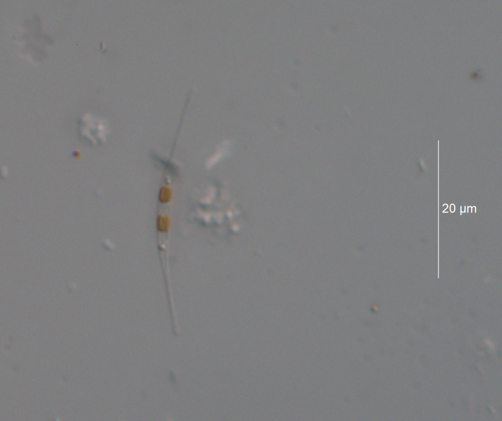 NJDEP| Division of Science and Research | Cylindrotheca closterium