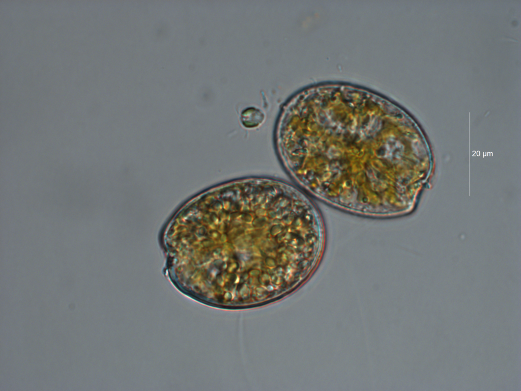 NJDEP| Division of Science and Research | Prorocentrum lima