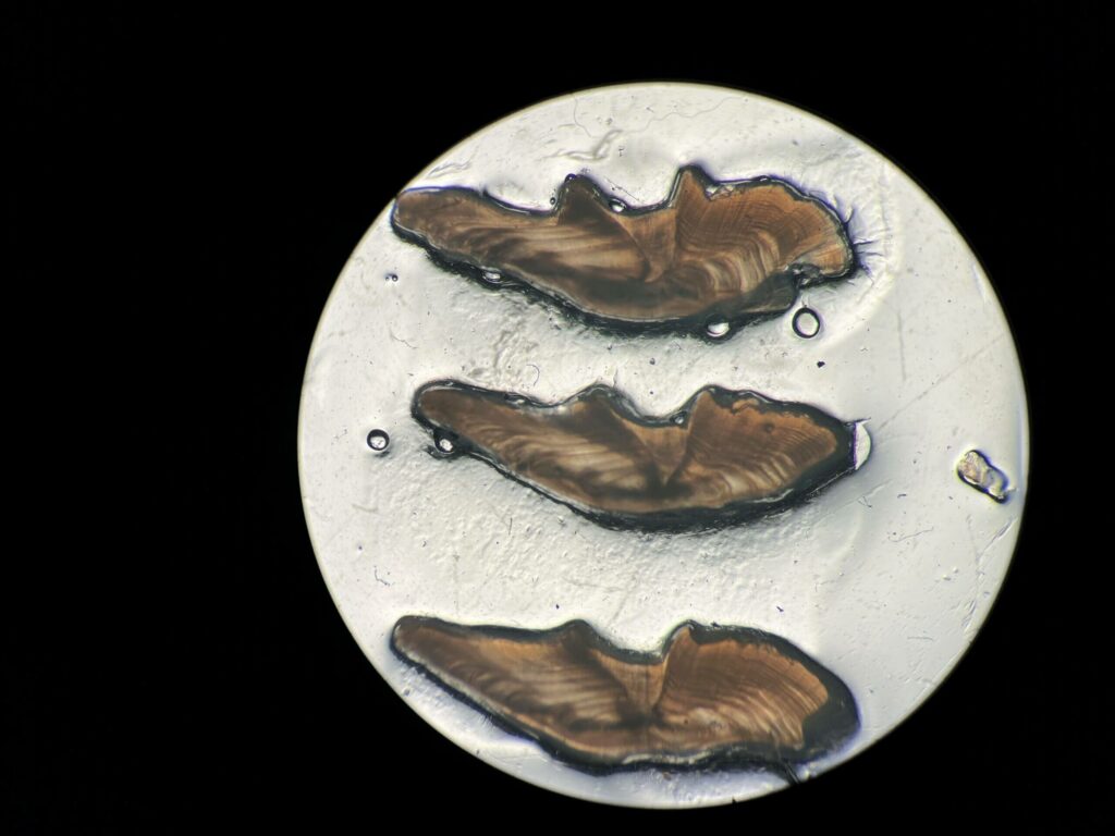 NJDEP| Fish & Wildlife | Finfish Age Determination